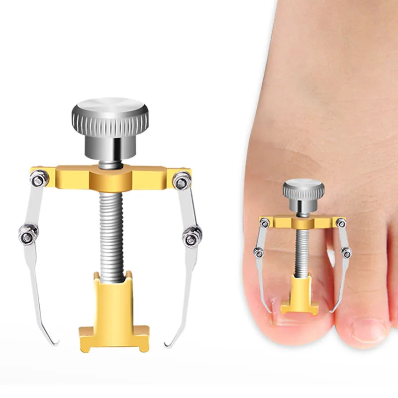 5pc Ingrown Toe Nail Set - i-Spa