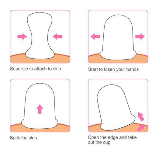 Silicone Cupping Set | 7pc Transparent – i-Spa